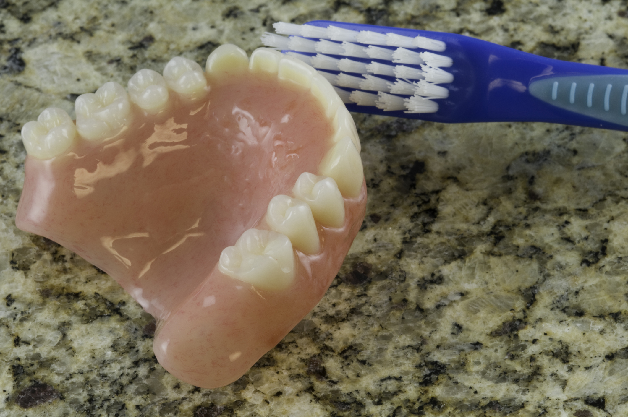 La prothèse dentaire complète amovible (Interventions dentaires) - ODQ